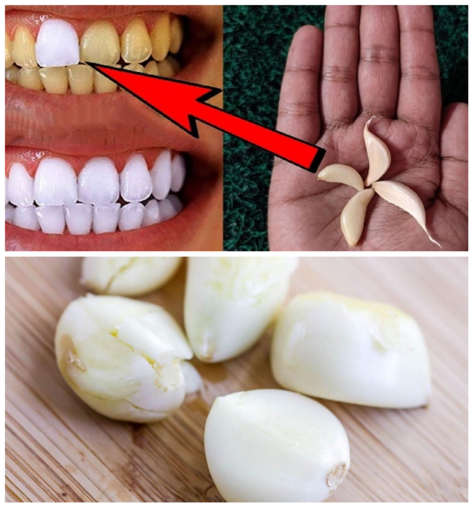 Unlock the Secret to a Brighter Smile with Garlic
